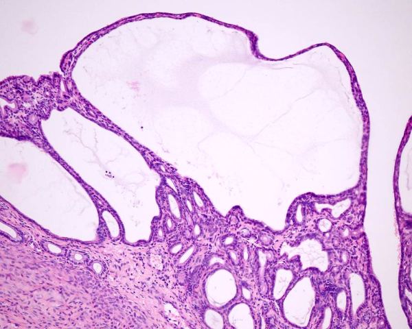 PATOLOGIA REPRODUCTIVA: MUCOMETRA EN GATA