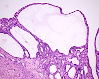 PATOLOGIA REPRODUCTIVA: MUCOMETRA EN GATA