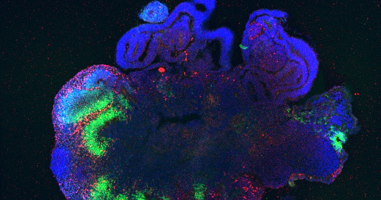 Scientificamente : Organóides - o nosso corpo em ponto pequeno
