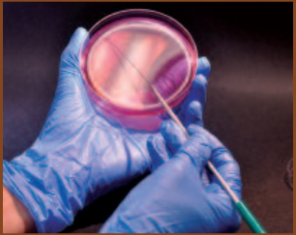 [Microbiology] Atlas of Streak Plate Methods of Isolation | Free ...