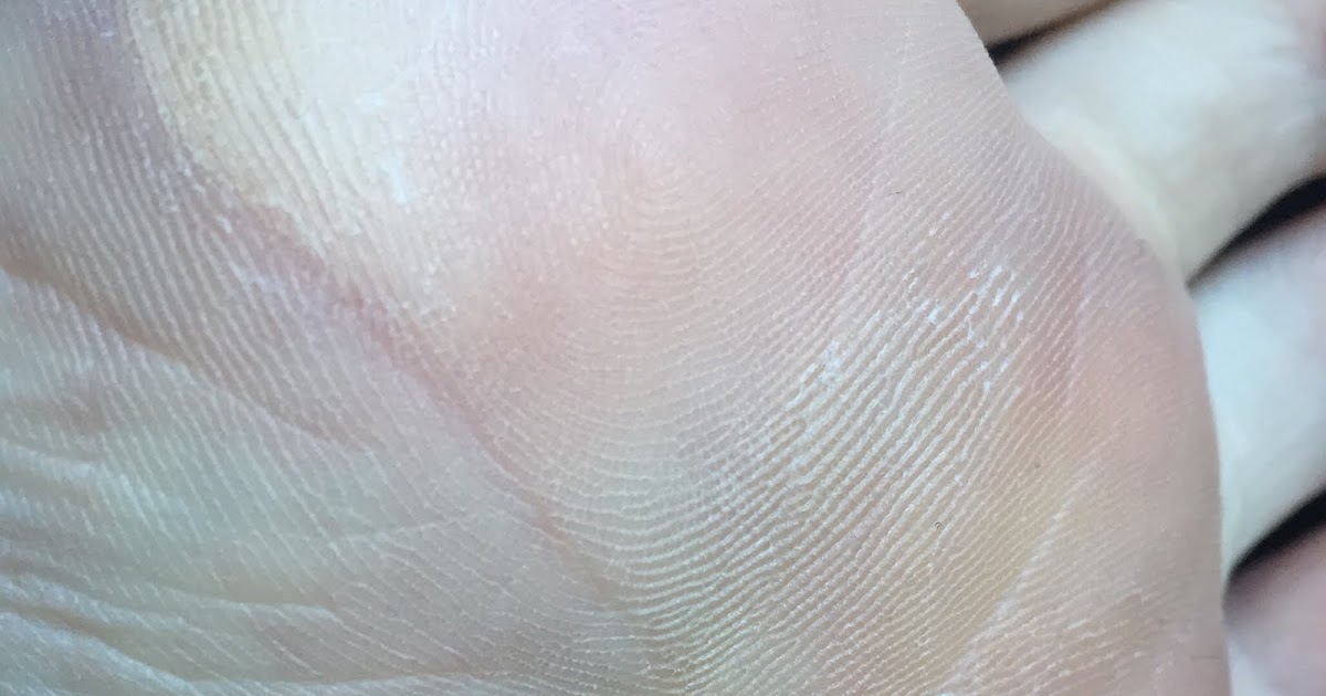 MFS124.SOPHIE.BAYLIS.ReflectiveJournal: Opacity and skin