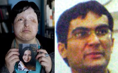 Ameneh Bahrami: an eye for an eye - Iran Justice system: Ameneh Bahrami ...