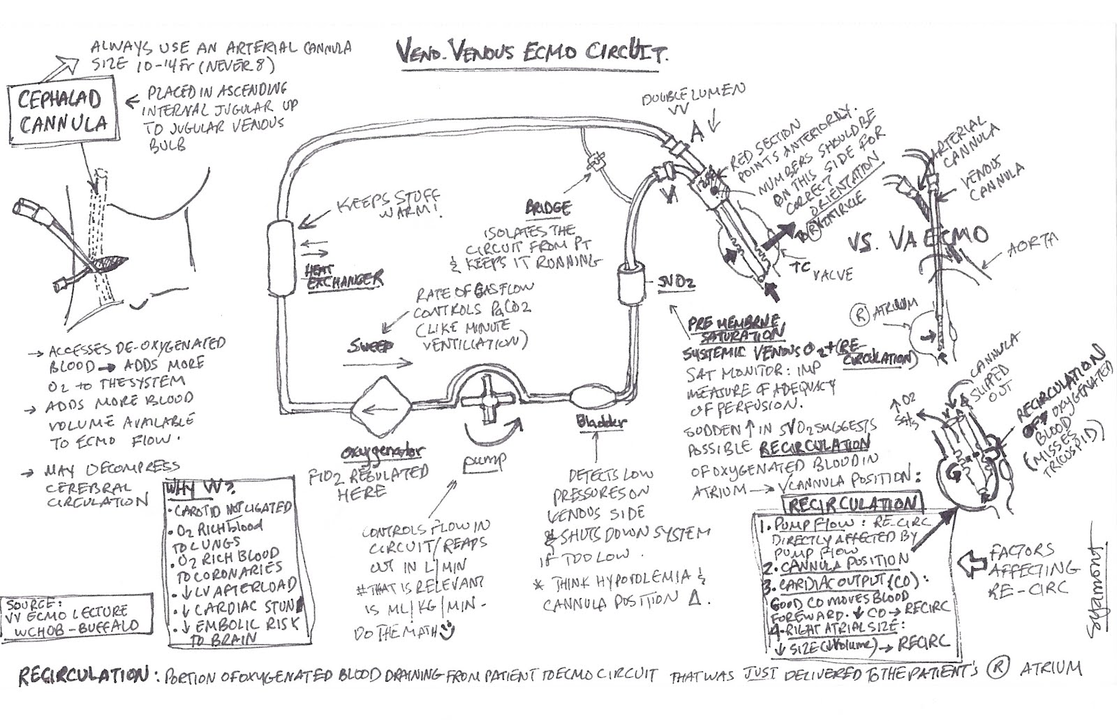 Pediatric Surgery Zone: Sketchnotes: VV ECMO