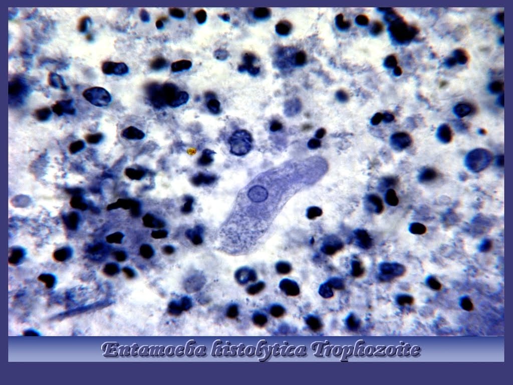 Fun With Microbiology (What's Buggin' You?): Entamoeba histolytica/dispar