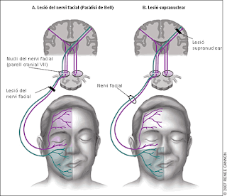 El rincón del resi MIR: ROTATORIO OTORRINOLARINGOLOGIA