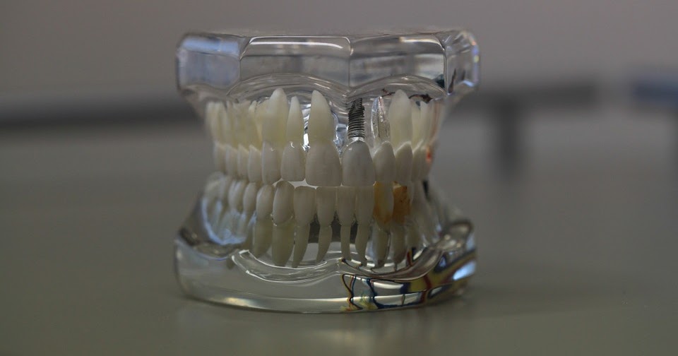 The Top 10 Dentures (False Teeth) Pop Outs!