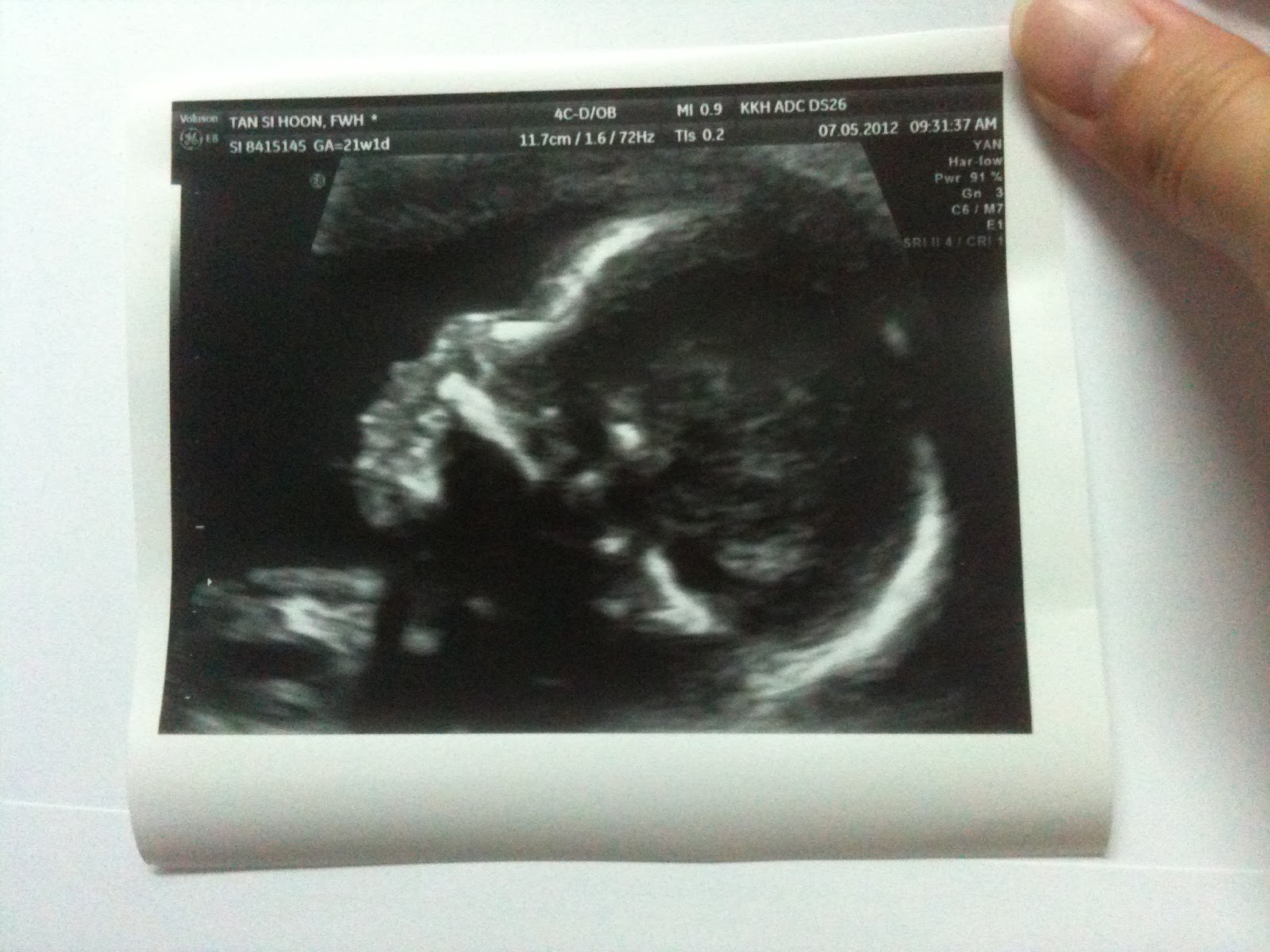 hOOnIe: 5 month detail scan