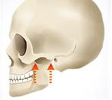 Eyelid Surgery Legend Dr. Kim Byung Gun: [BK Plastic Surgery Hosptial ...