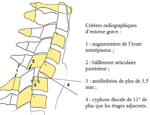 Un médecin du sport vous informe: Rachis cervical et rugby