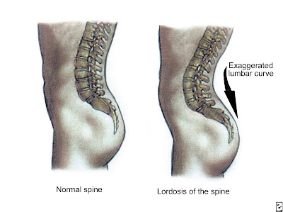 Pregnancy Tips, Blogs: When do the postural changes of pregnancy occur?