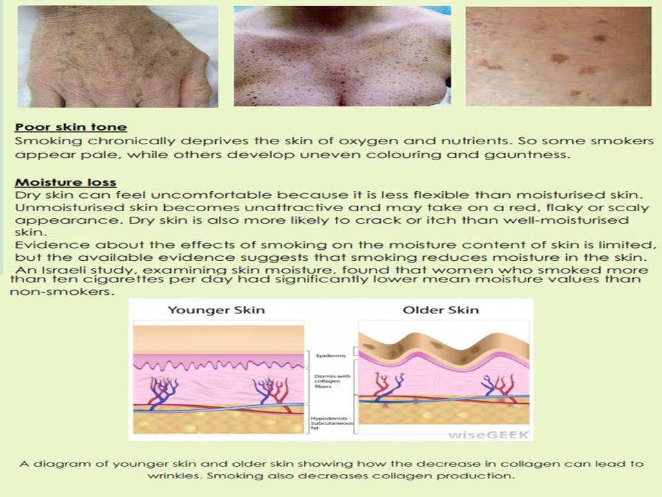 Bodytique An essential treatment: Effects of smoking on skin health