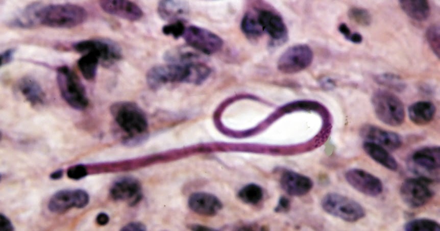 Avances de la ciencia en Guatemala: Rodolfo Robles Valverde