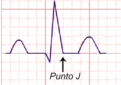 ICC: 5. Enfermedad Coronaria
