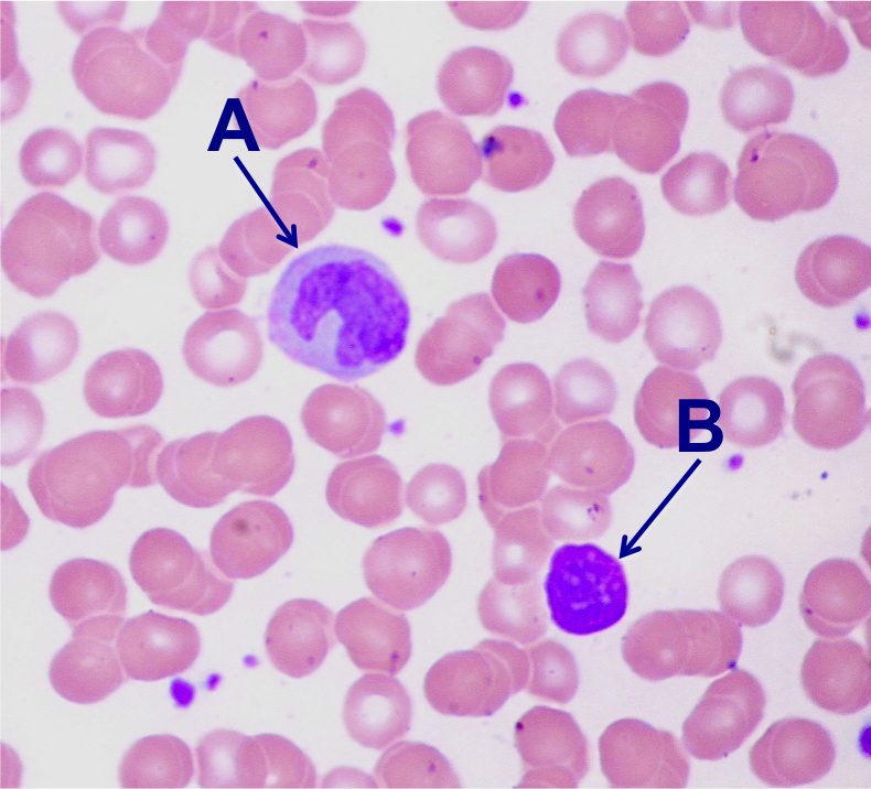 SOS BIOLOGIA CELULAR Y TISULAR: SANGRE. LEUCOCITOS 2