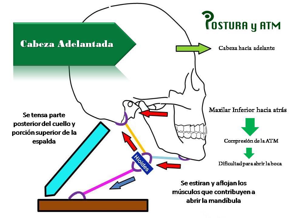 Postura y ATM