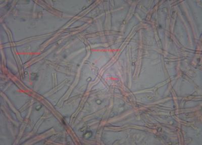 Misidentifying Fungi: March 2018