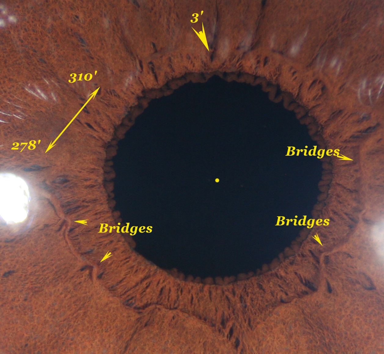 Modern & Multidimensional Iridology: The Pupil, IPB, Pupillary Zone ...