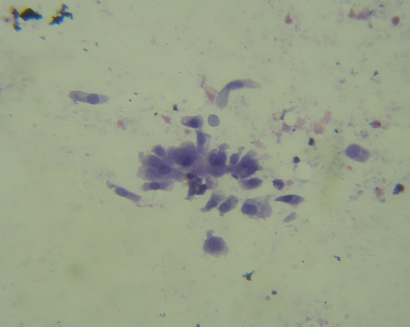 into the roots: A few crazy cells