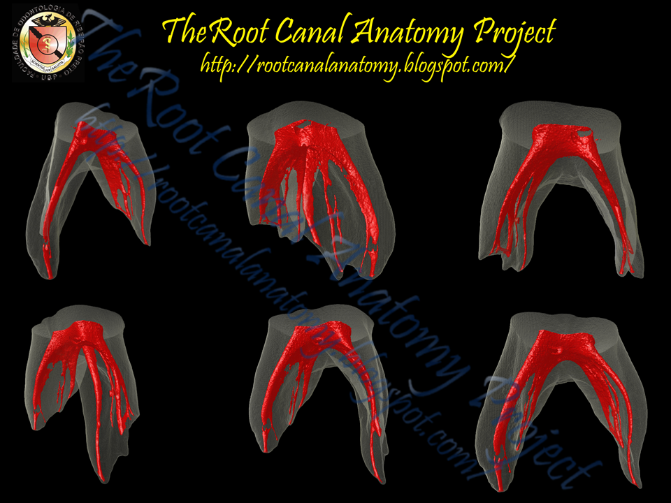 The Root Canal Anatomy Project: Primary molars are easy!
