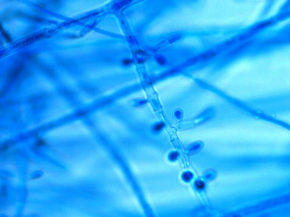 Fun With Microbiology (What's Buggin' You?): Trichophyton tonsurans