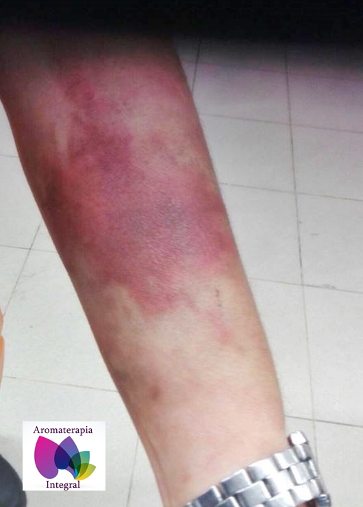 Aromaterapia Integral Valencia: 2017