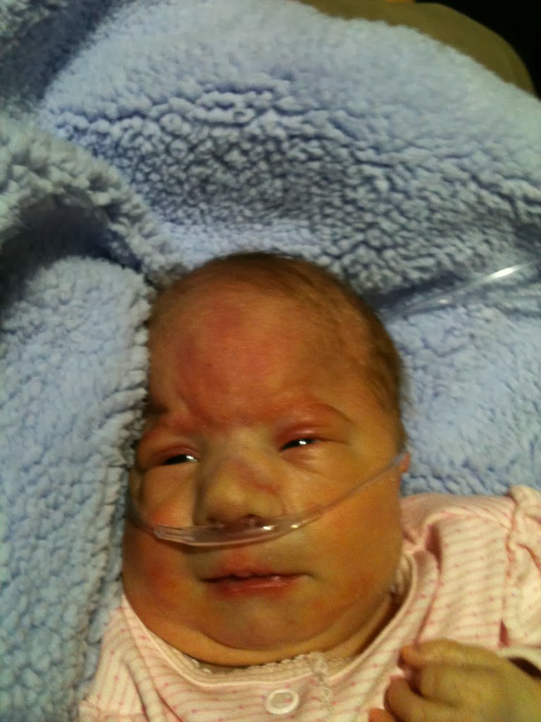 Savannah: 13 Stories of Trisomy 13 | Still Playing School