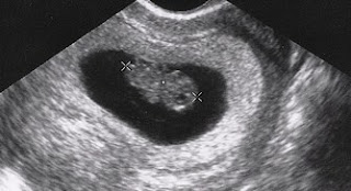 First Choice Baby Scan: Ultrasound in the First Trimester.....