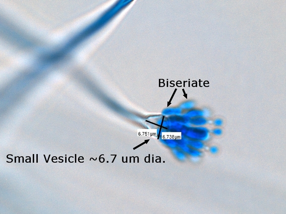 Fun With Microbiology (What's Buggin' You?): Aspergillus calidoustus