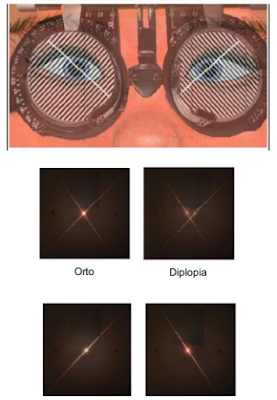 Cátedra N° 11 - Estudio sensoriomotor