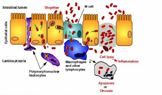 Infection Detection: Shigellosis