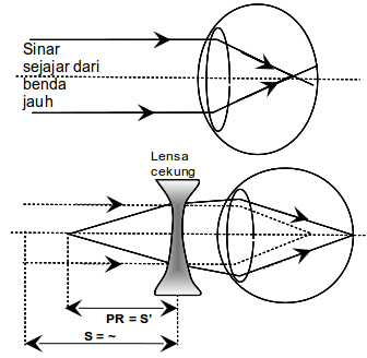 Alat Optik: Kacamata Untuk Penglihatan yang Lebih Baik