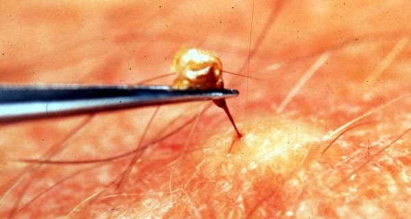 Kako protiv uboda pčela, osa ili insekata? – Narodna Apoteka