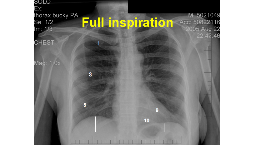 Positioning and Related Anatomy for X-ray Imaging