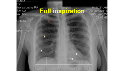 Positioning and Related Anatomy for X-ray Imaging
