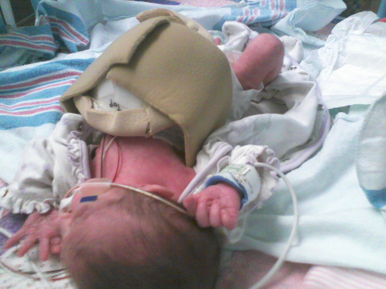 Growth of our special Bean: Turtle Shell