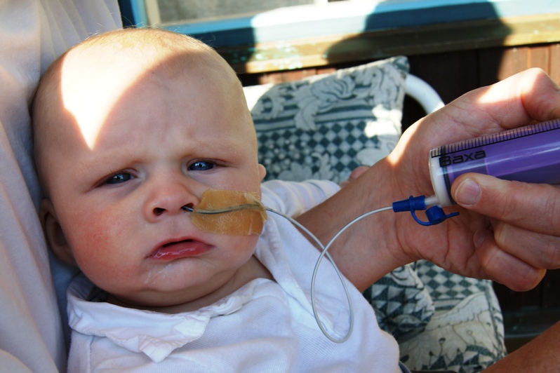 Benjaminimalimaten: Uppriktigt om sondmatning