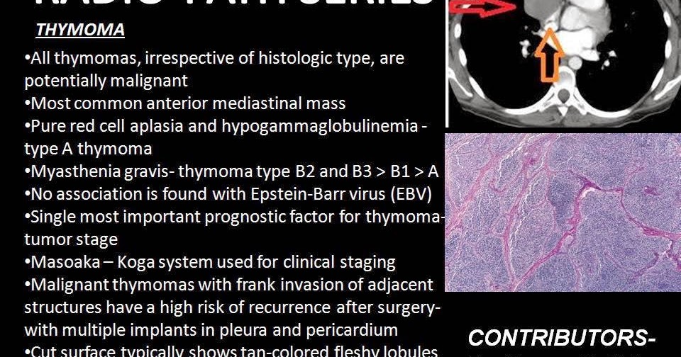 Thymoma-Radio-Path Series - Sumer's Radiology Blog
