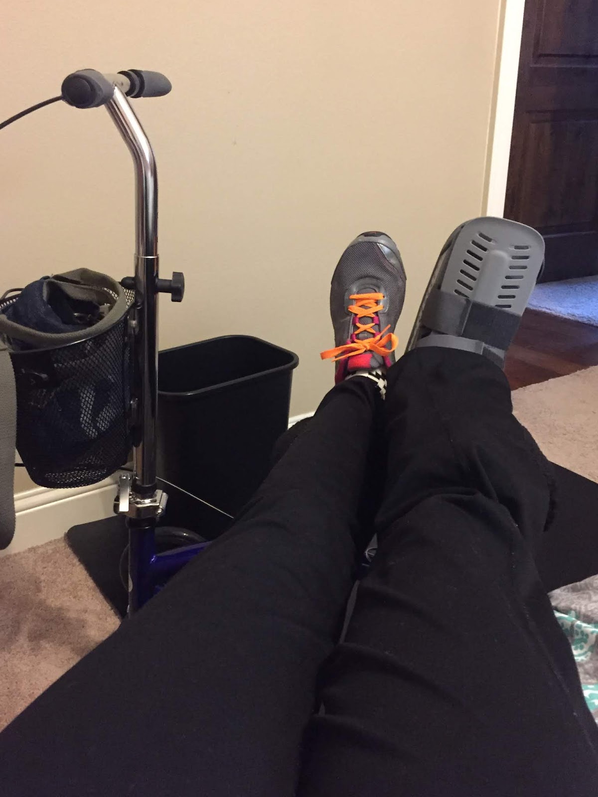 All About My 1st MPJ Foot Fusion