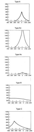 Tympanometry screening for middle ear problems available free in ...