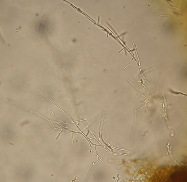 ATLAS MICOLOGIA: TRICHOPHYTON SOUDANENSE