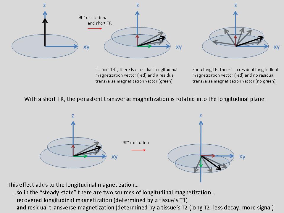 The Pump and the Tubes: Maximum fluid intensity -- bSSFP MRA