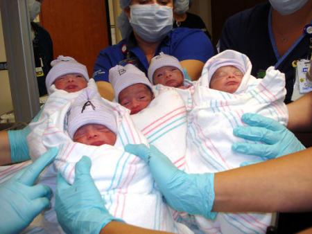 Talktokemi (TtK) : A 23 Years Old Gives Birth to Quintuplets