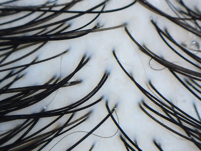 Para que serve os principais tipos de pêlos no corpo humano? | Saiba um ...