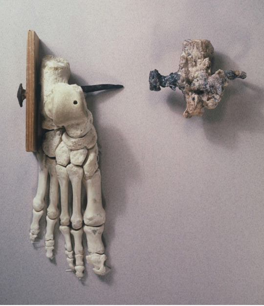 Eli Eli... They Pierced My Hands and My Feet!