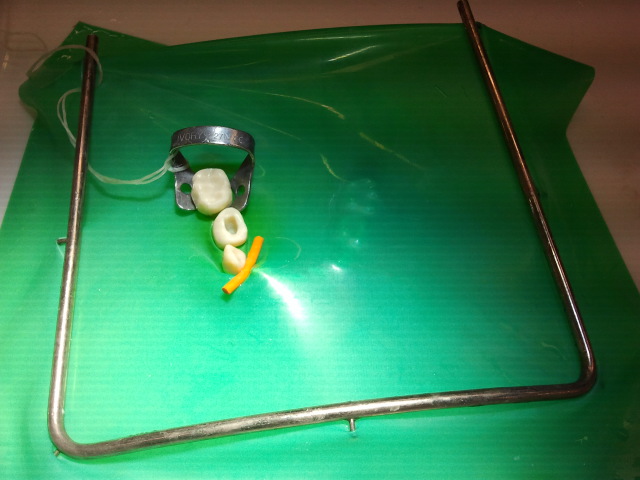 Dentistry: Pulpotomy