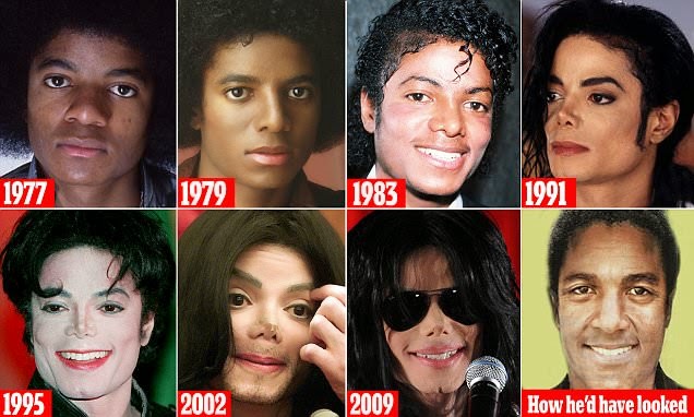 ETL NEWS BLOG: Michael Jackson had 100 operations, see how he would ...