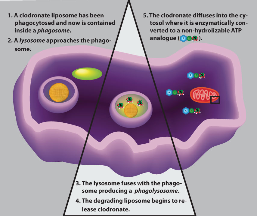 Liposomal Clodronate And The Health | Lose Weight Home