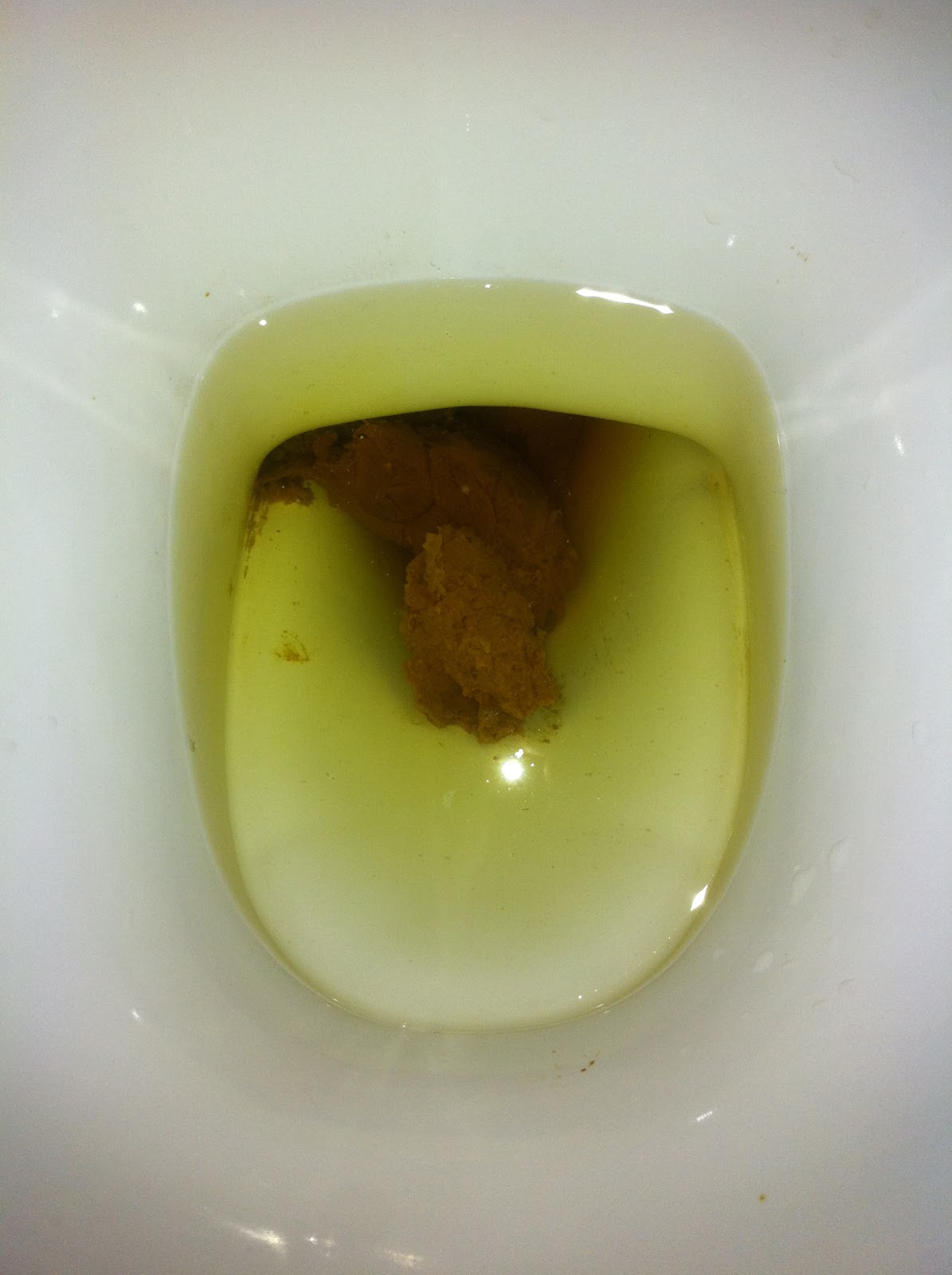 Neil's World of Feces