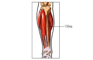 Healthy Habits: Top 4 Causes of Shin Splints