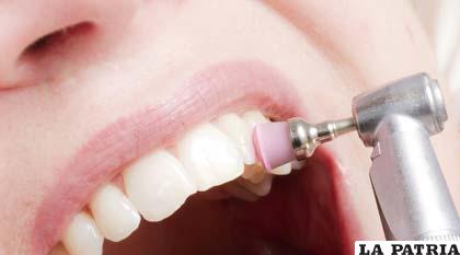 Profilaxis dental | Odontologia Preventiva